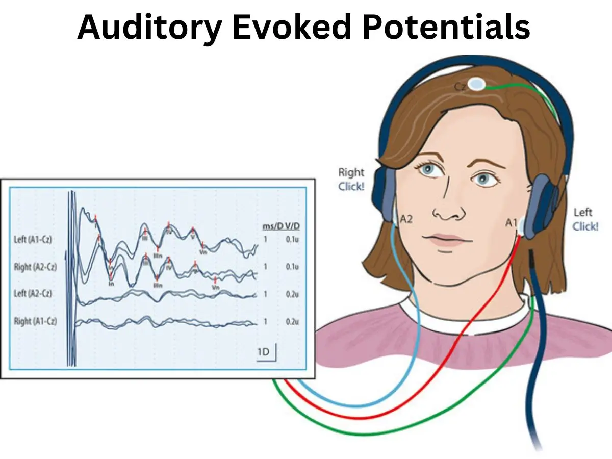 Auditory Evoked Potentials Example Of Visual And Auditory Evoked